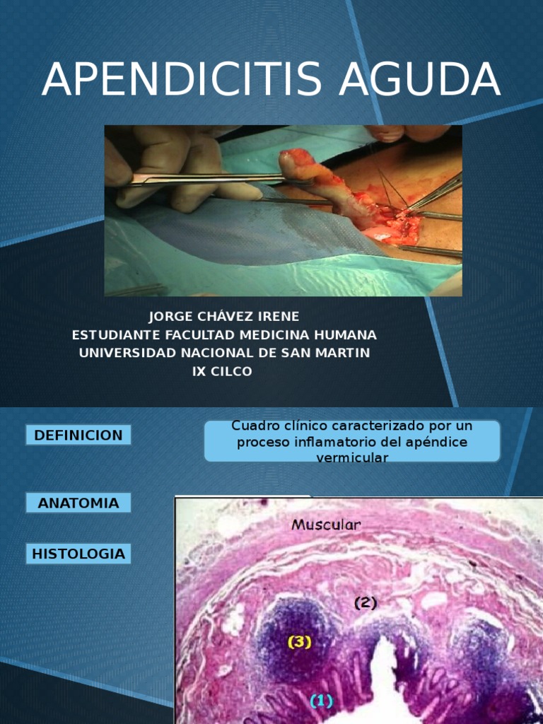 Apendicitis Aguda | PDF | Medicina CLINICA | Síntomas y signos