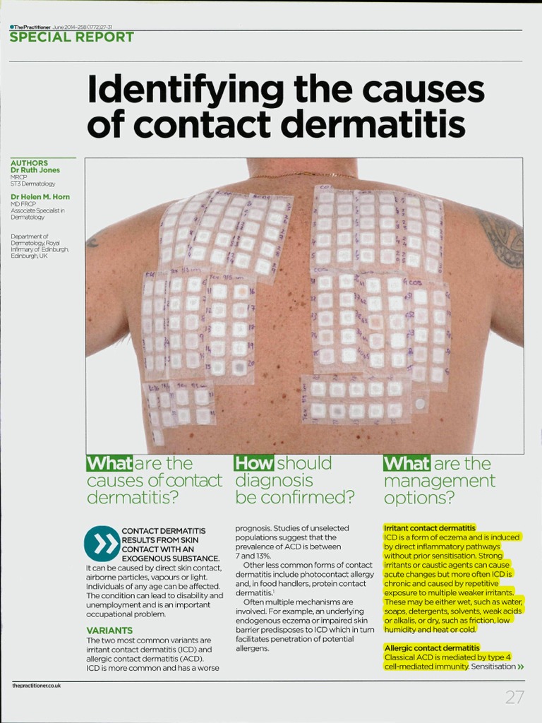 Identifying The Cause of Contact Dermatitis | PDF | Dermatitis ...