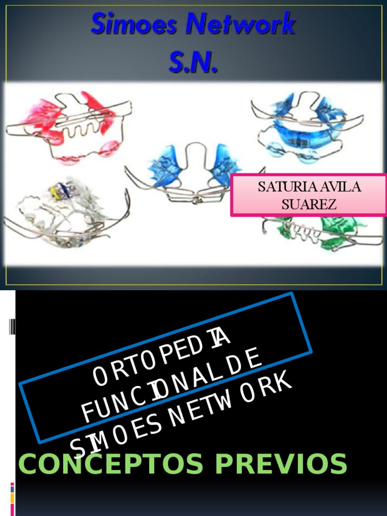 Tipos y objetivos de los aparatos Simoes Network (SN) en ortopedia funcional de los maxilares ...