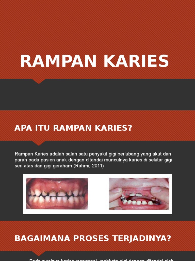 Panduan Cegah Rampan Karies Anak | PDF
