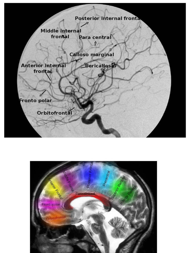 Anterior Cerebral Artery Variants Analysis | PDF