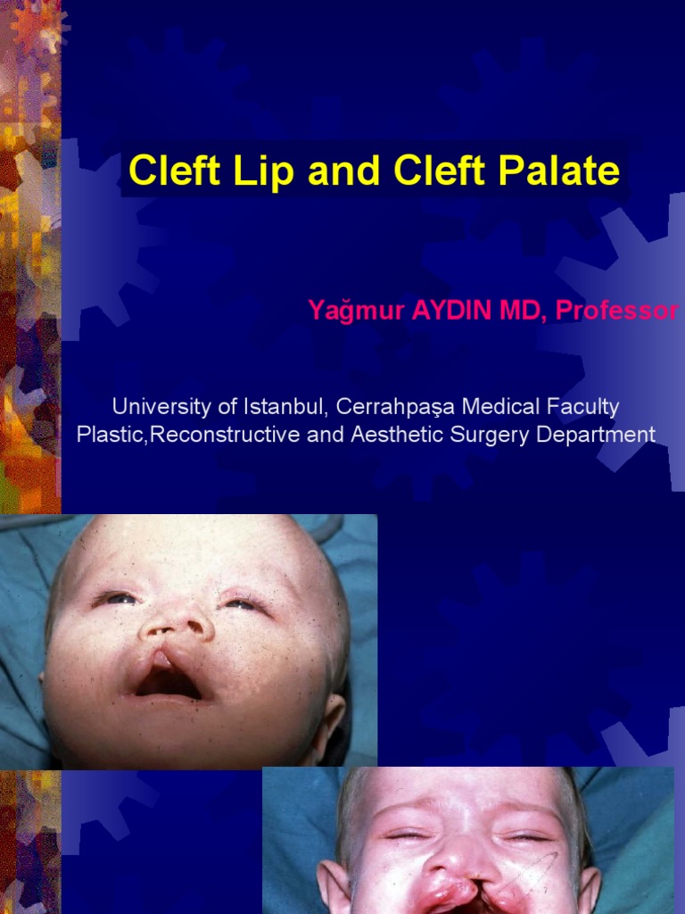 Cleft and Palate | PDF | Human Anatomy | Human Head And Neck
