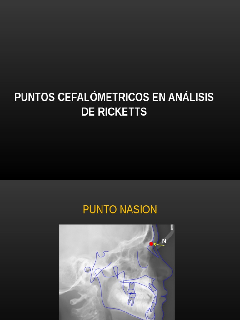 Puntos Cefalómetricos en Análisis de Ricketts | Cara | Anatomía humana