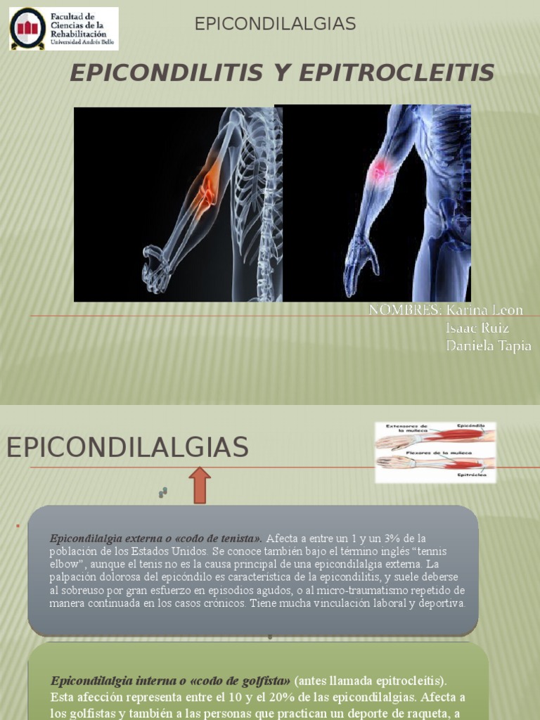 Epicondilitis y Epitrocleitis
