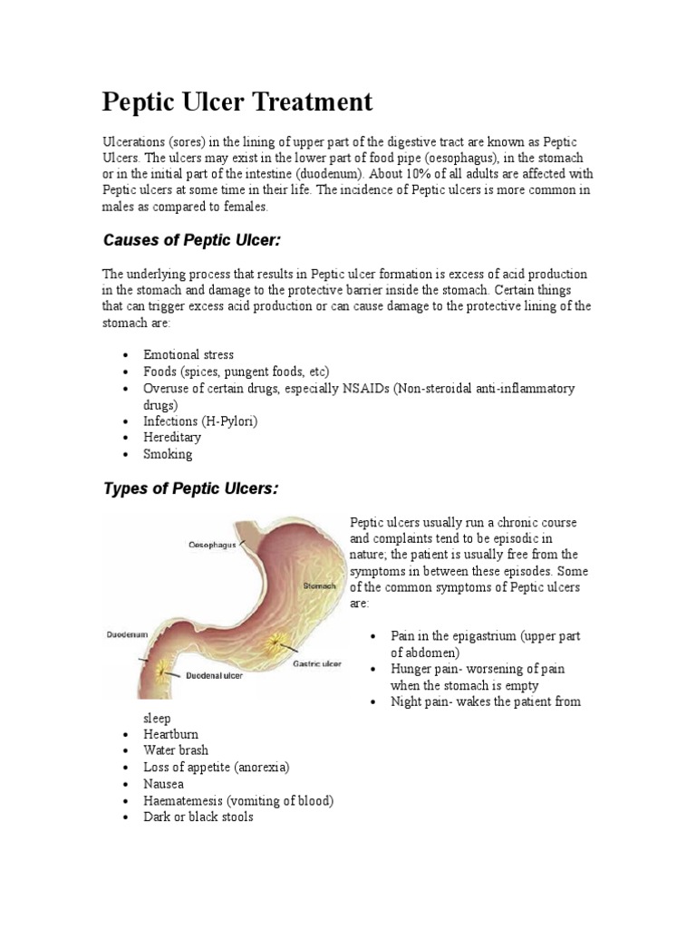 Peptic Ulcer Treatment | PDF | Clinical Medicine | Gastroenterology