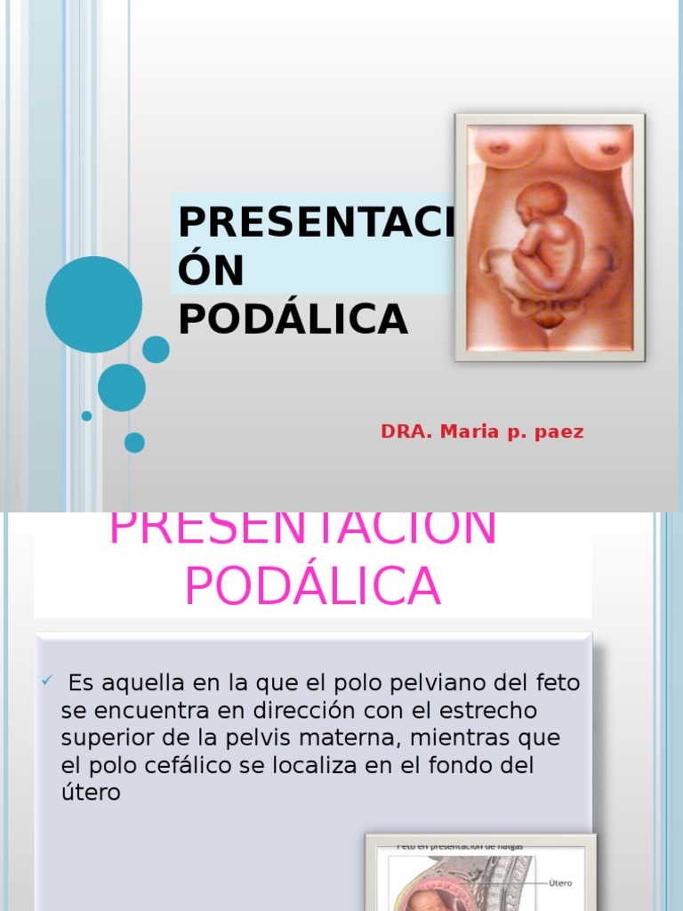 Presentación Podálica: Tipos y Manejo | PDF | Parto | Pelvis