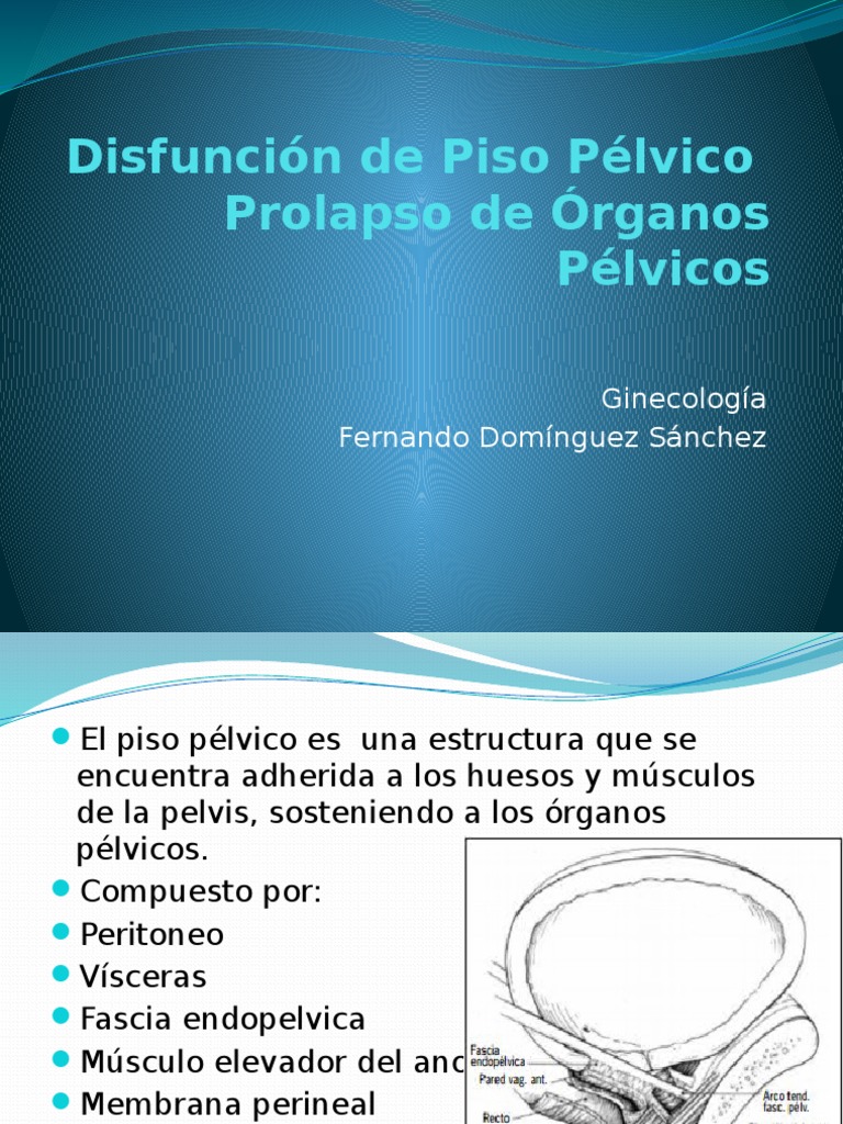 Prolapso de Órganos Pélvicos | PDF | Pelvis | Vagina