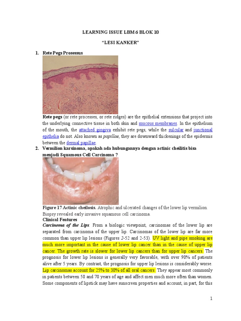 Learning Issue LBM 6 Blok 10 | PDF | Metastasis | Epithelium