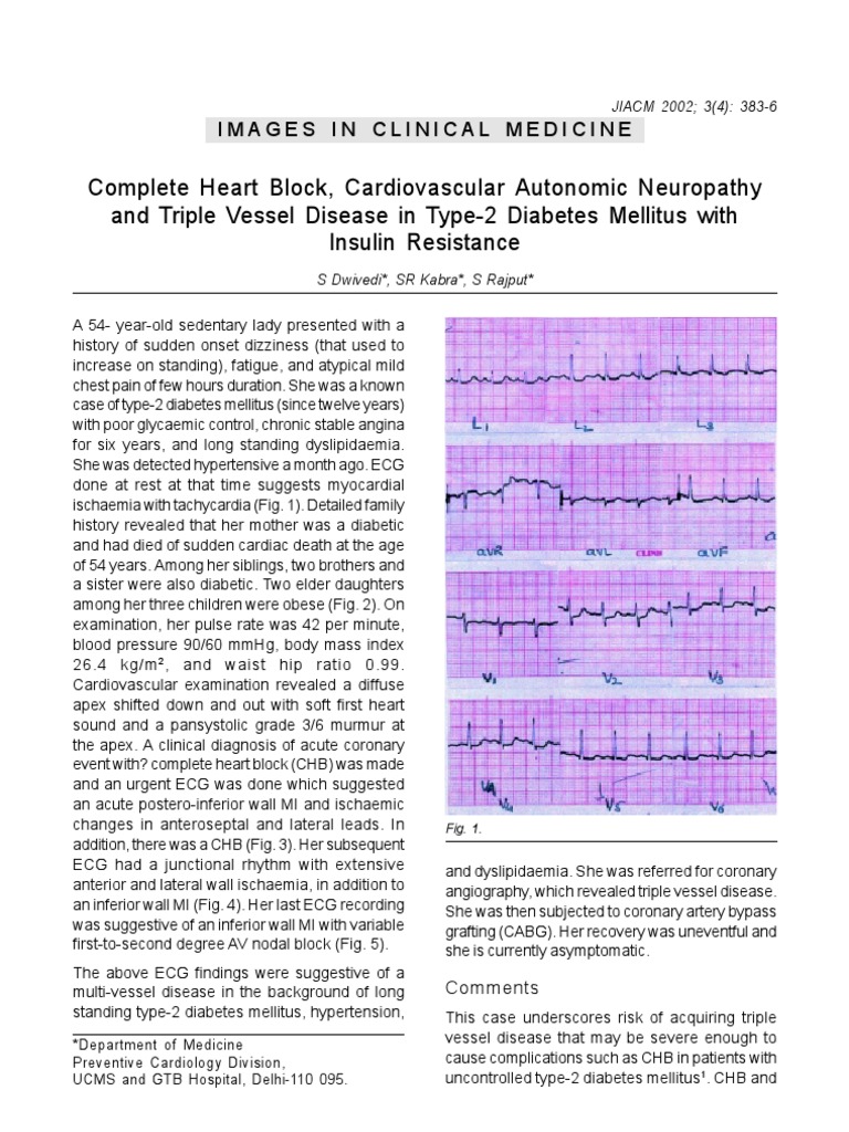 tvd | Cardiovascular Diseases | Heart