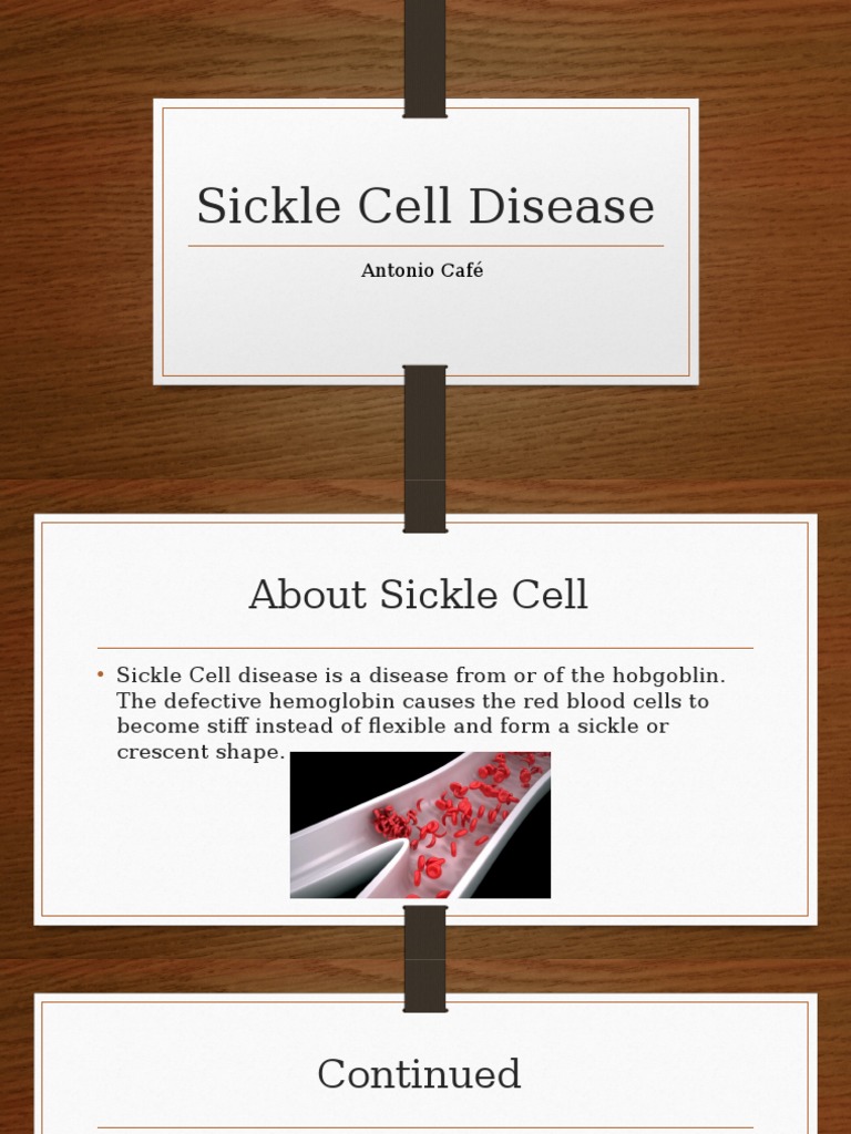Sickle Cell Disease | PDF