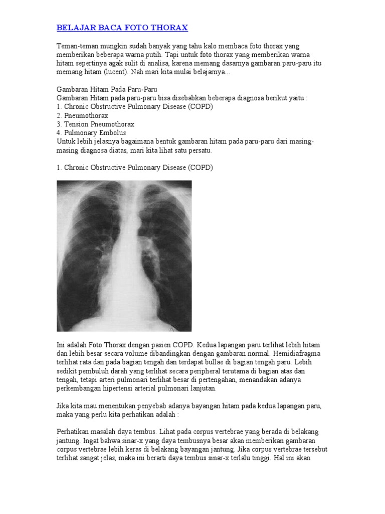 Panduan Membaca Foto Thorax Medis | PDF