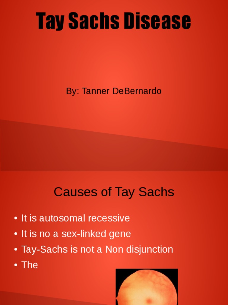 Understanding Tay Sachs Disease: Causes, Symptoms, and Treatment | PDF