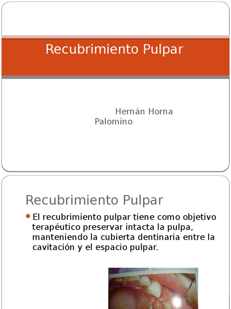 Recubrimiento Pulpar | PDF | Diente humano | Ciencias de la Salud