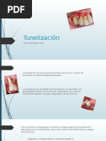 Proceso Alveolar | PDF | Hueso | Anatomía