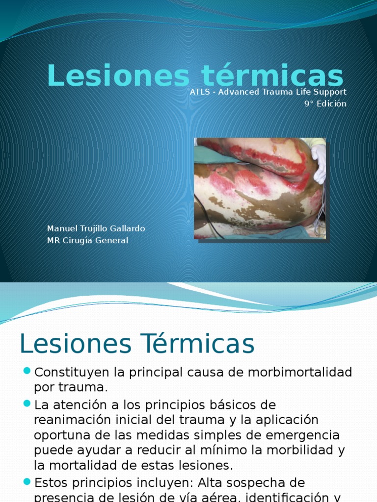 Lesiones Térmicas | Quemar | Enfermedades y trastornos