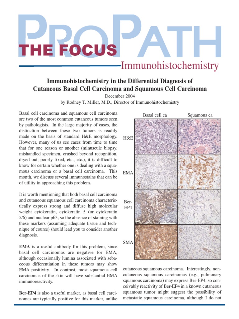 Basal Cell vs Squamous | Carcinoma | Immunohistochemistry