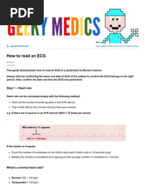 My Notes For Usmle Basics For The Wards How To Read Ekgs