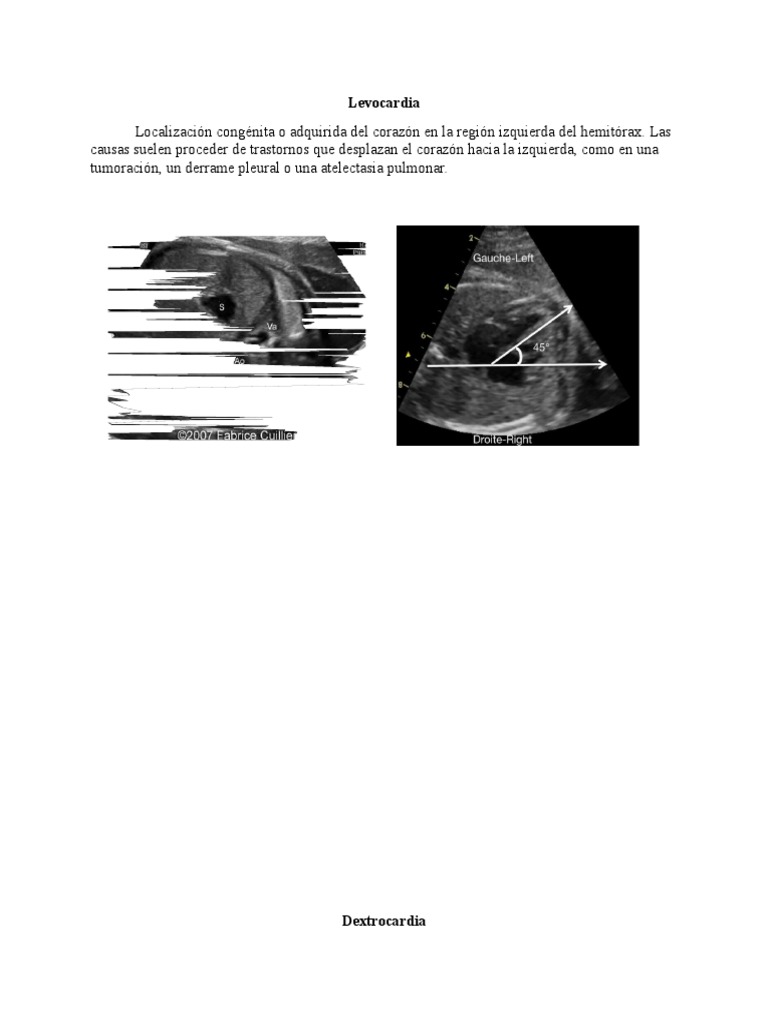 levocardia | Especialidades Medicas | Enfermedades y trastornos