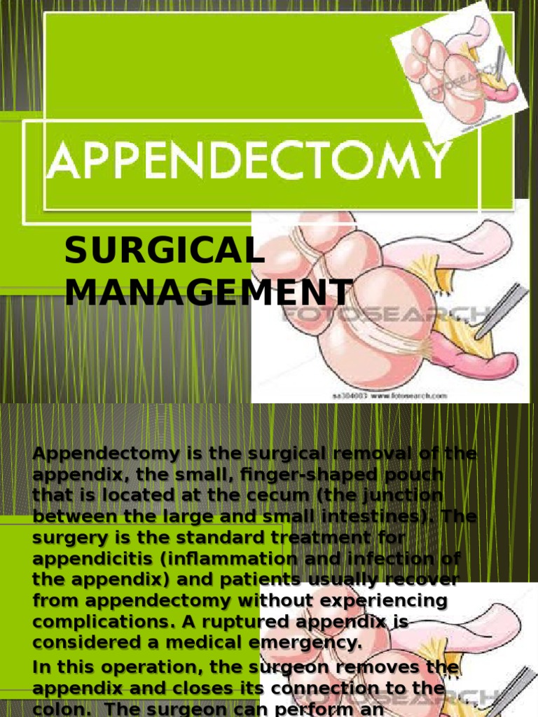 Appendectomy Case Presentation Surgery Medicine