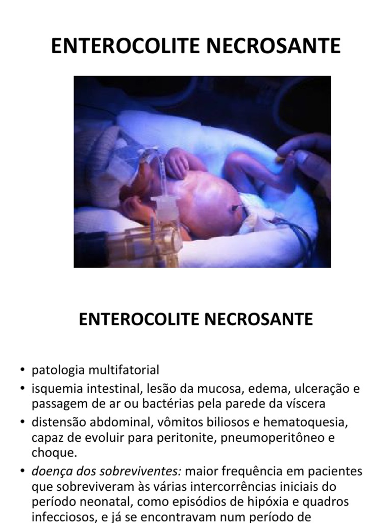 Enterocolite-necrosante