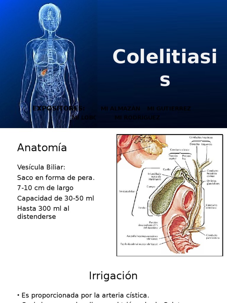 Colelitiasis | PDF