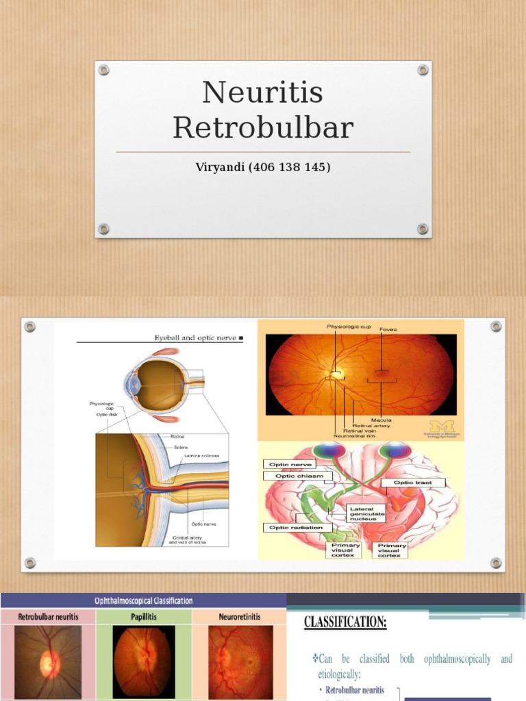 Neuritis Retrobulbar | PDF