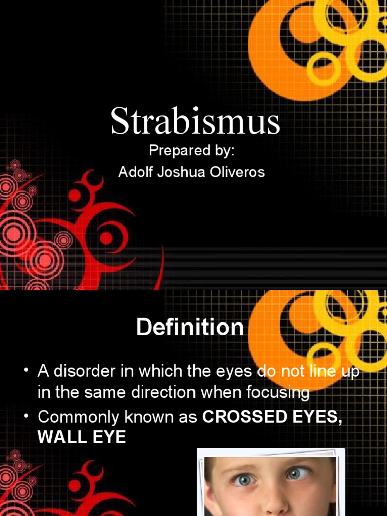 Strabismus: Prepared By: Adolf Joshua Oliveros | PDF | Human Eye | Rtt