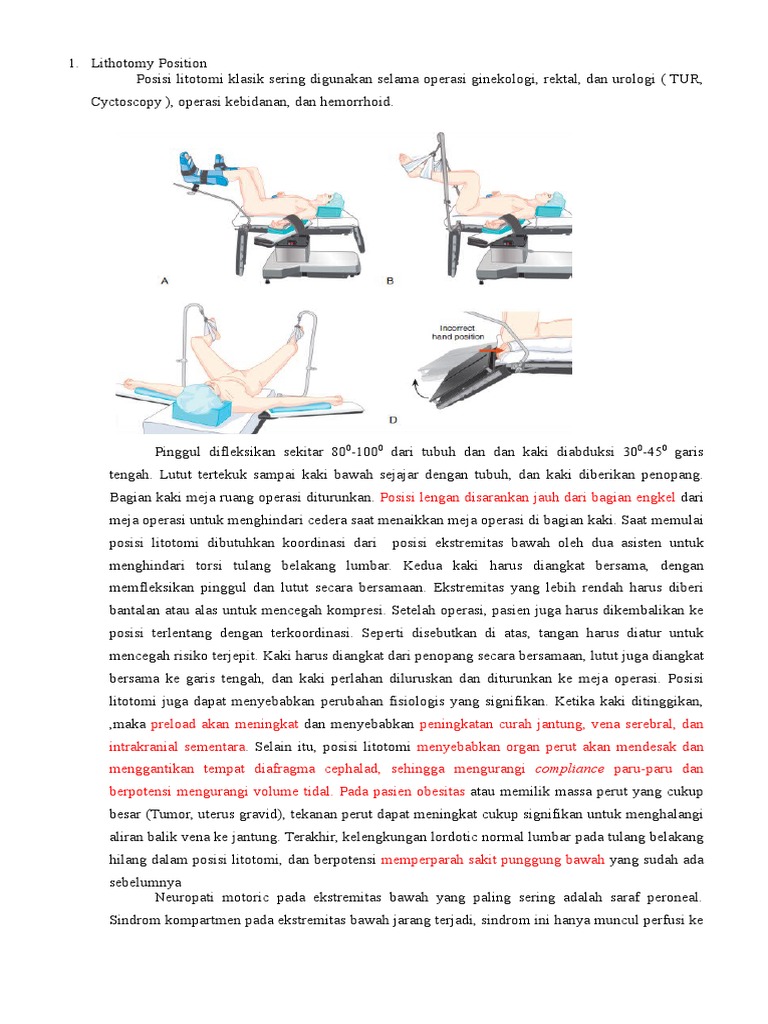 Posisi Operasi | PDF | Kesehatan Holistik