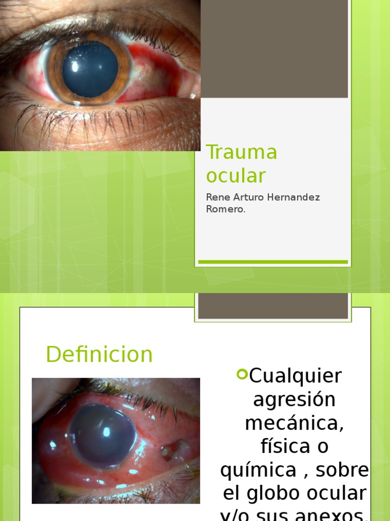 Trauma Ocular 3 | PDF | Lesión | Ojo humano