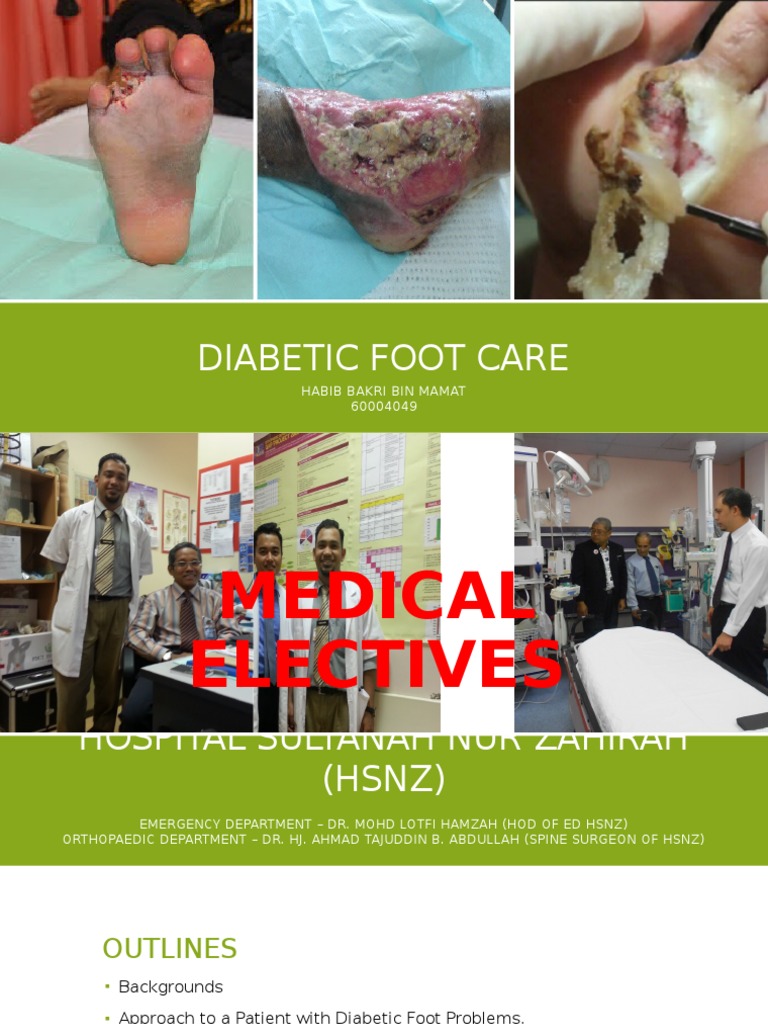 Management of Diabetic Foot | PDF | Wound | Diabetes Mellitus