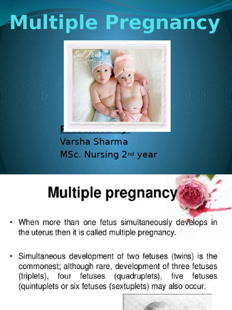 Multiple Pregnancy: Presented by | PDF | Twin | Multiple Births