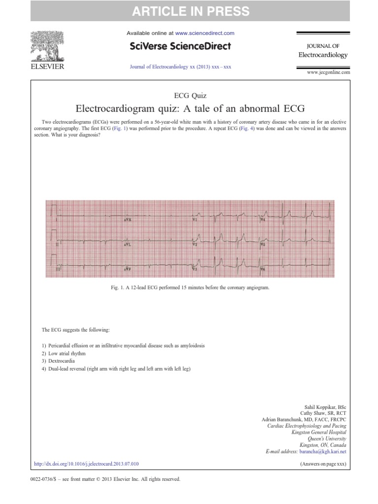 ECG Quiz | PDF | Electrocardiography | Organ (Anatomy)