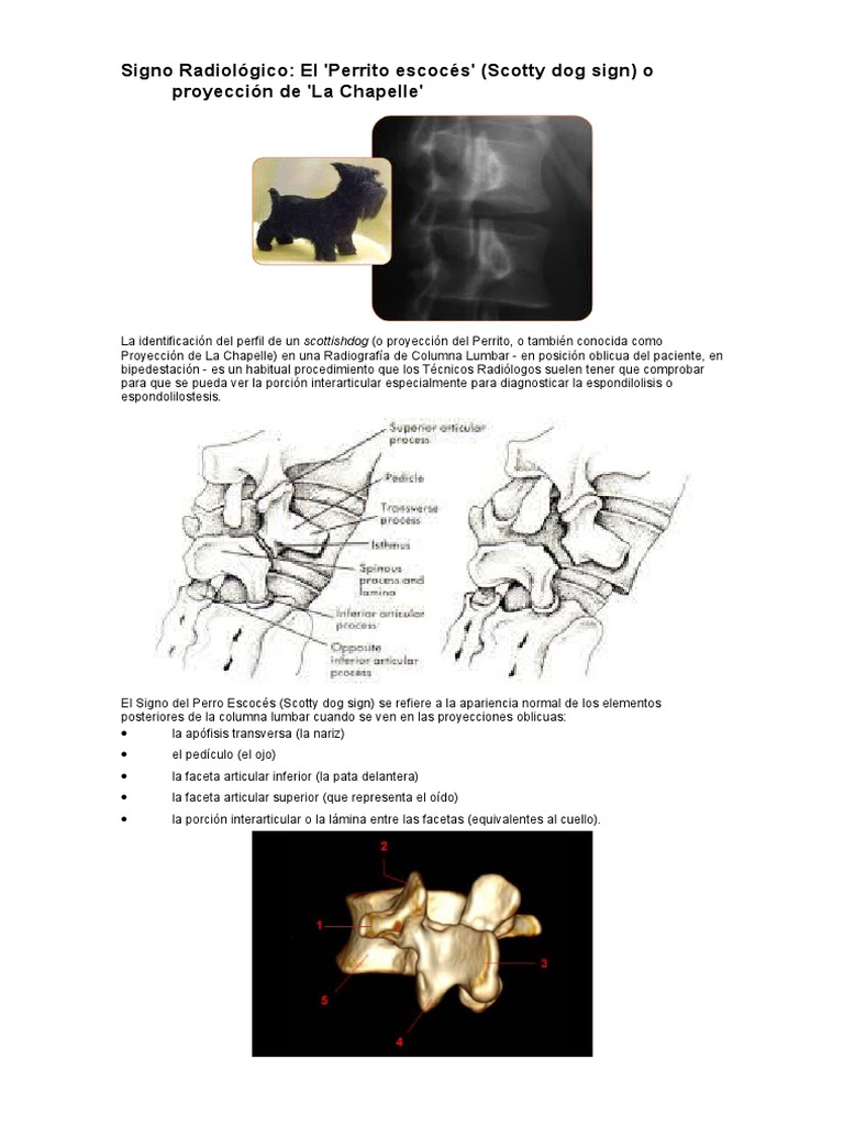 Signo Radiológico Perrito Escoces | PDF | Vértebra | Medicina