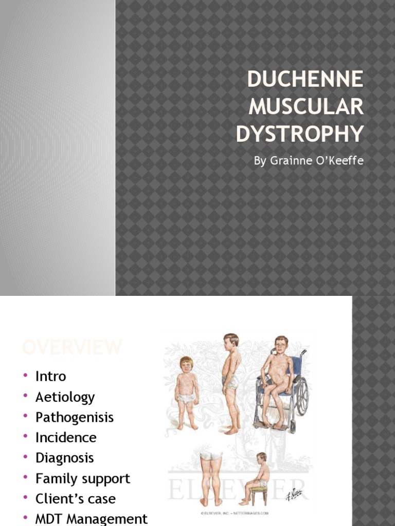 Duchenne Muscular Dystrophy Overview | PDF | Muscular Dystrophy ...
