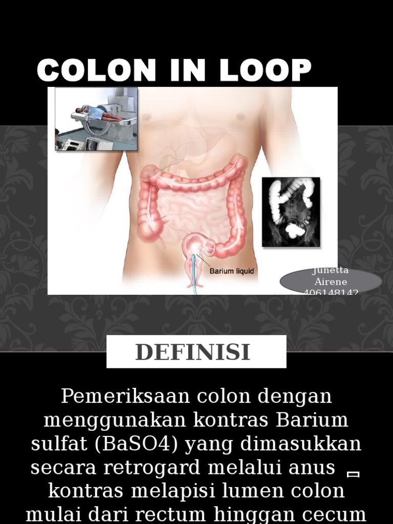 Colon in Loop | PDF