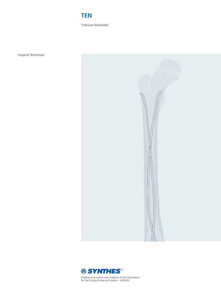 TEN-Titanium Elastic Nail | PDF | Anatomical Terms Of Location | Human Leg