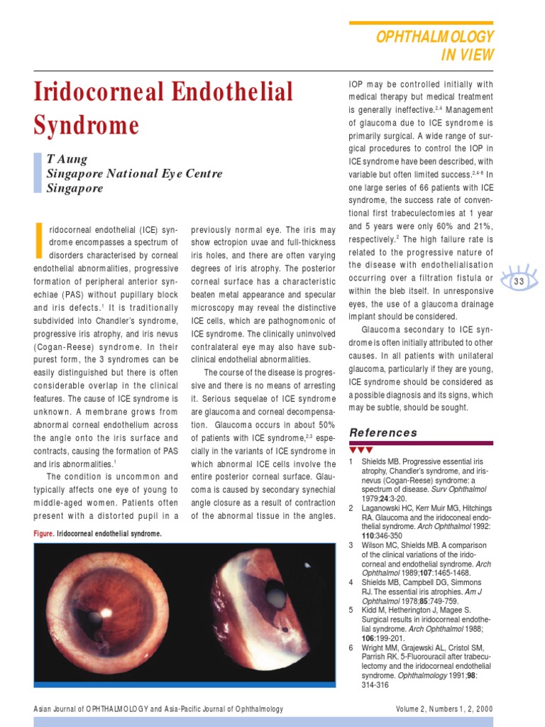 ICE Syndrome | PDF | Glaucoma | Ophthalmology