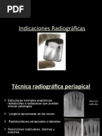 Radiografia de Cavum y Atm | PDF | Articulación | Sistema ...