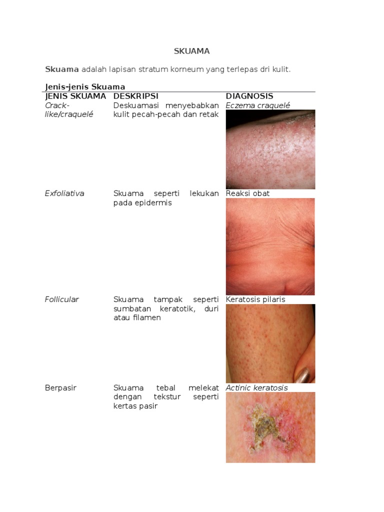 Deskripsi Jenis-Jenis Skuama Kulit | PDF