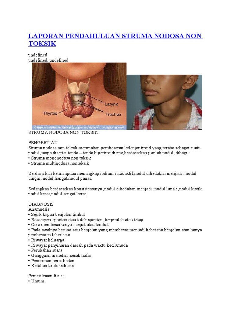Laporan Pendahuluan Struma Nodosa Non Toksik (SNNT) | PDF