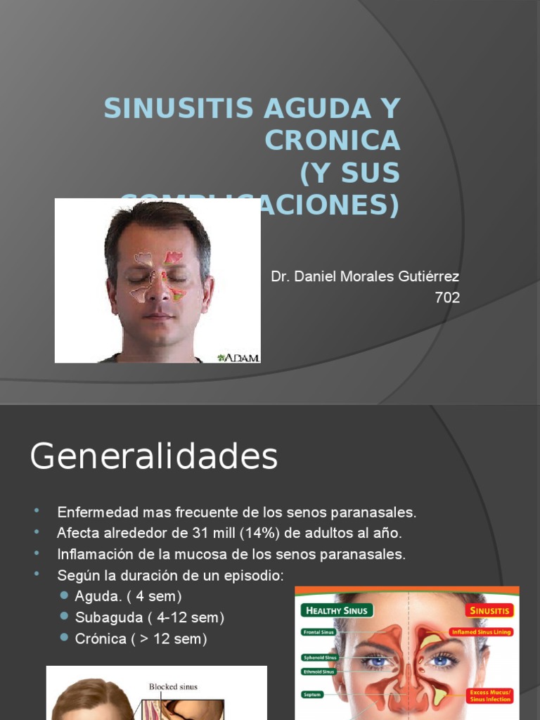 Sinusitis Aguda y Cronica-1 | PDF | Rtt | Epidemiología