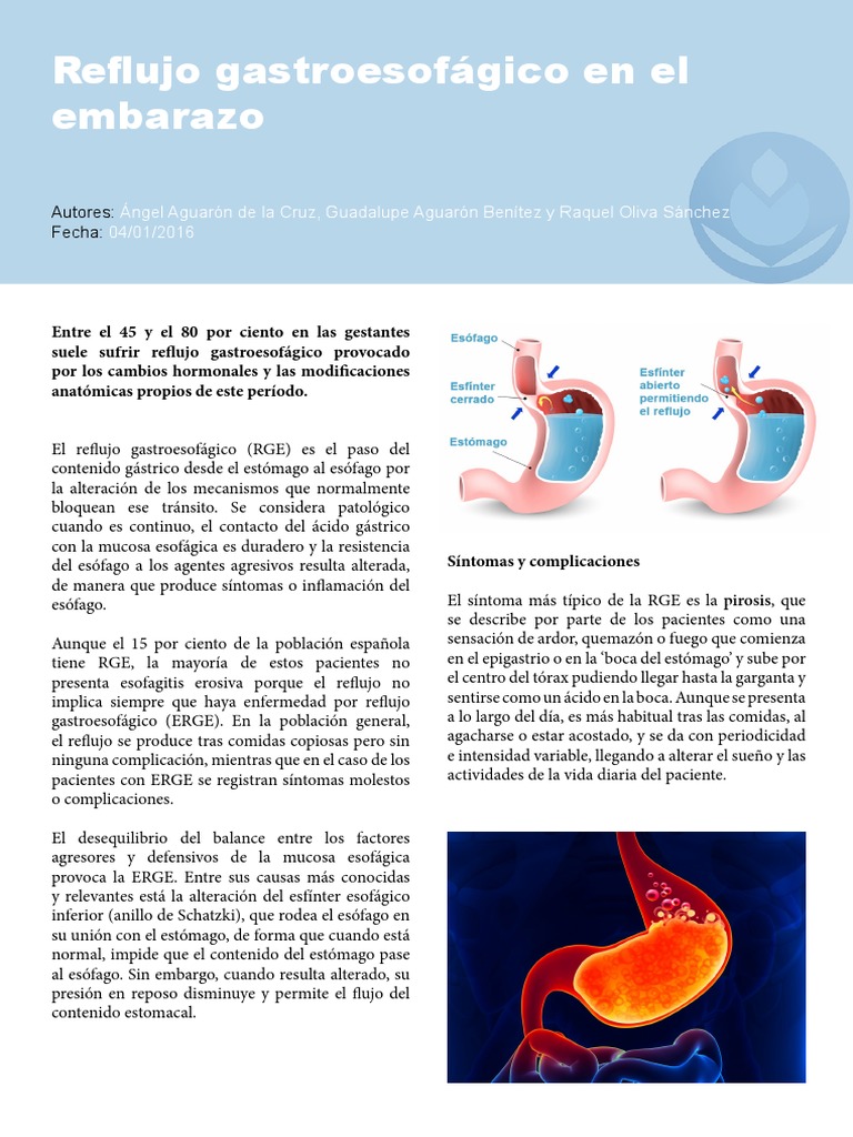 Reflujo en el Embarazo: Guía y Tratamiento | PDF | La enfermedad por ...