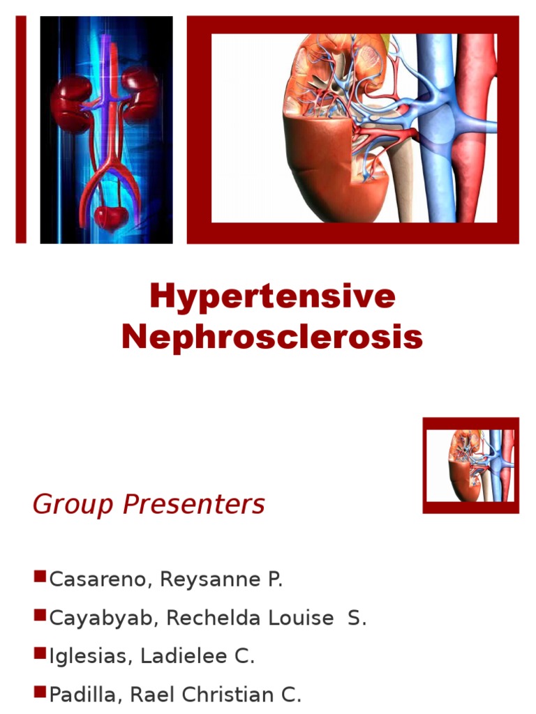 Hypertensive Nephrosclerosis | PDF | Hypertension | Chronic Kidney Disease