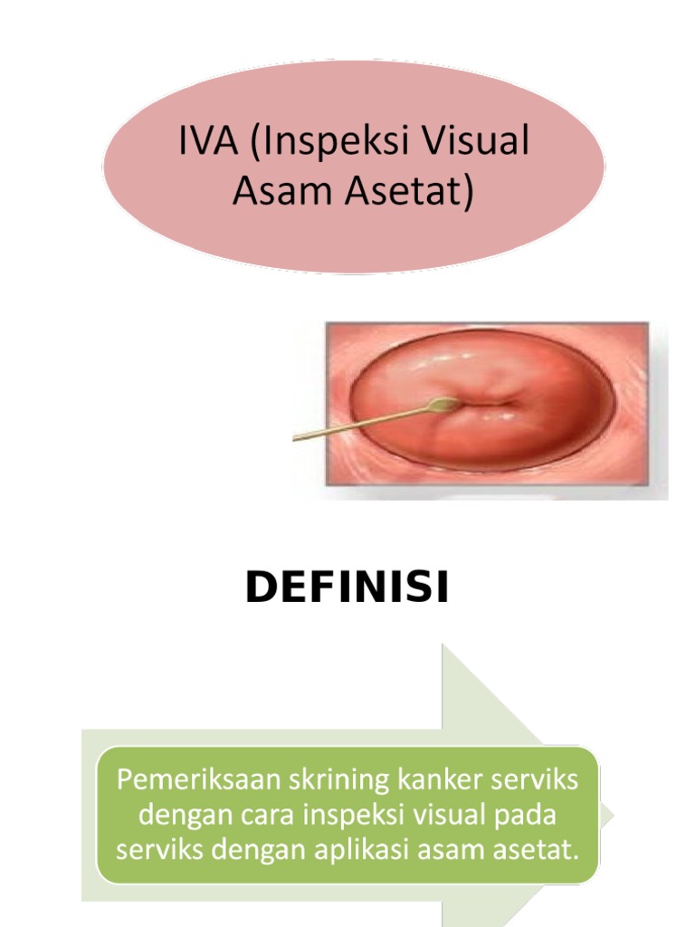 IVA (Inspeksi Visual Asam Asetat) | PDF