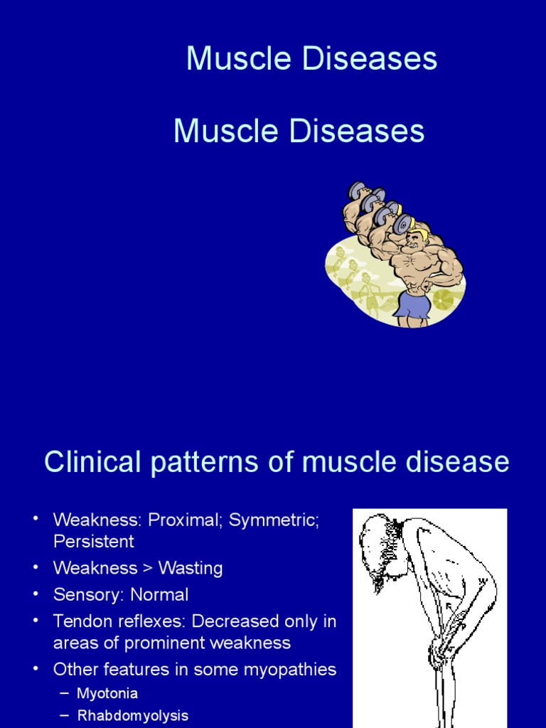 Muscle Diseases | Muscular Dystrophy | Muscle