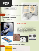 Pitch y TC Helicoidal | PDF | Ct Scan