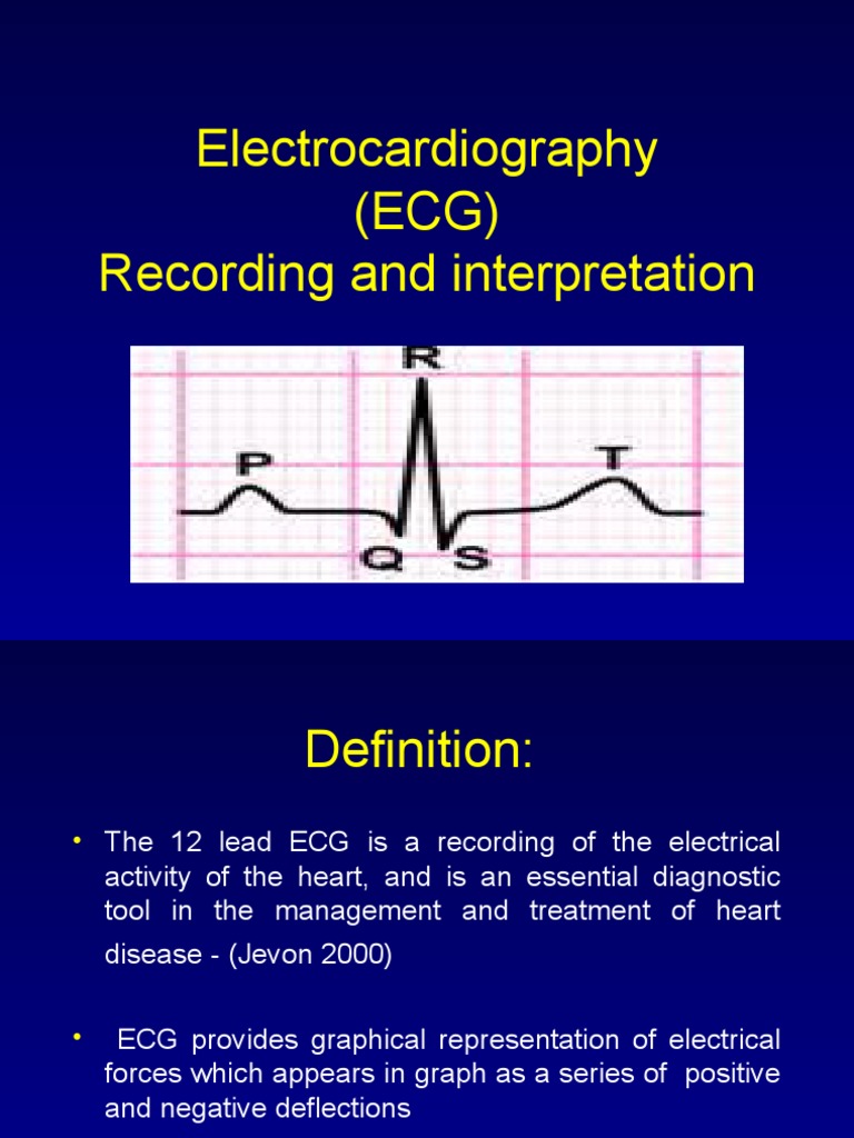 Electrocardiography (ECG) Recording and Interpretation | PDF ...