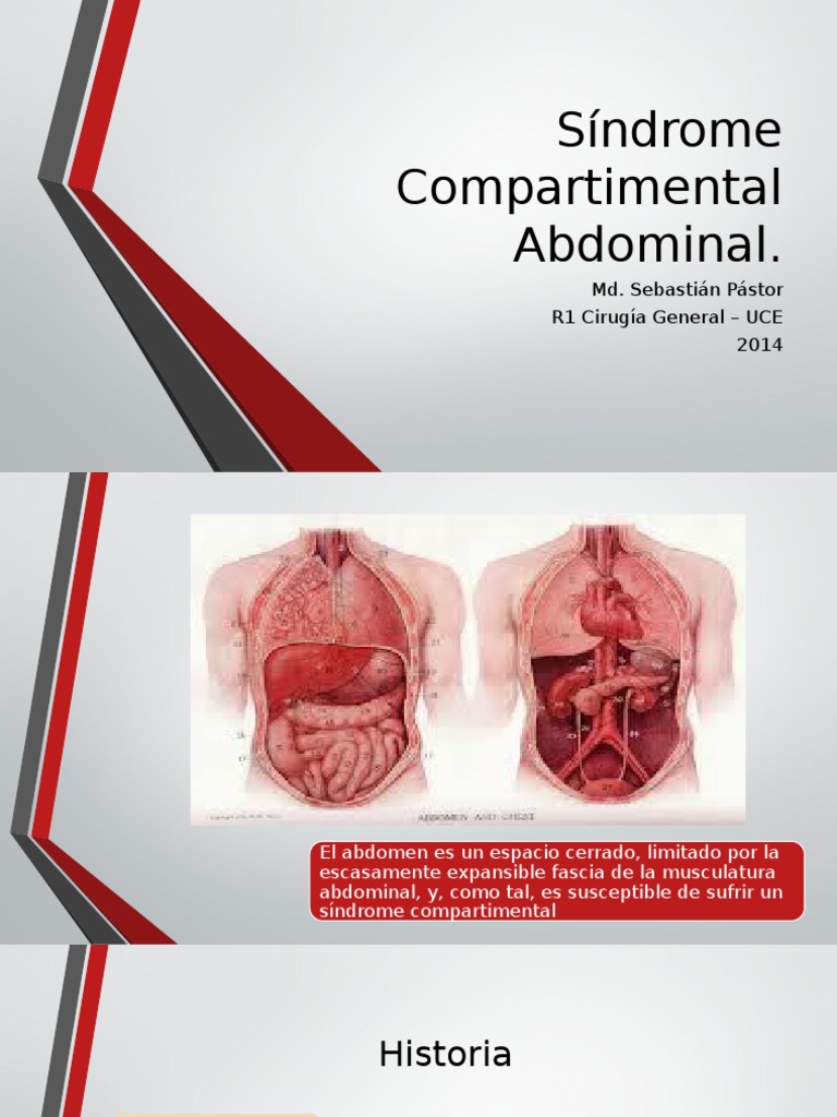 Síndrome Compartimental Abdominal: Tratamiento | PDF | Abdomen ...
