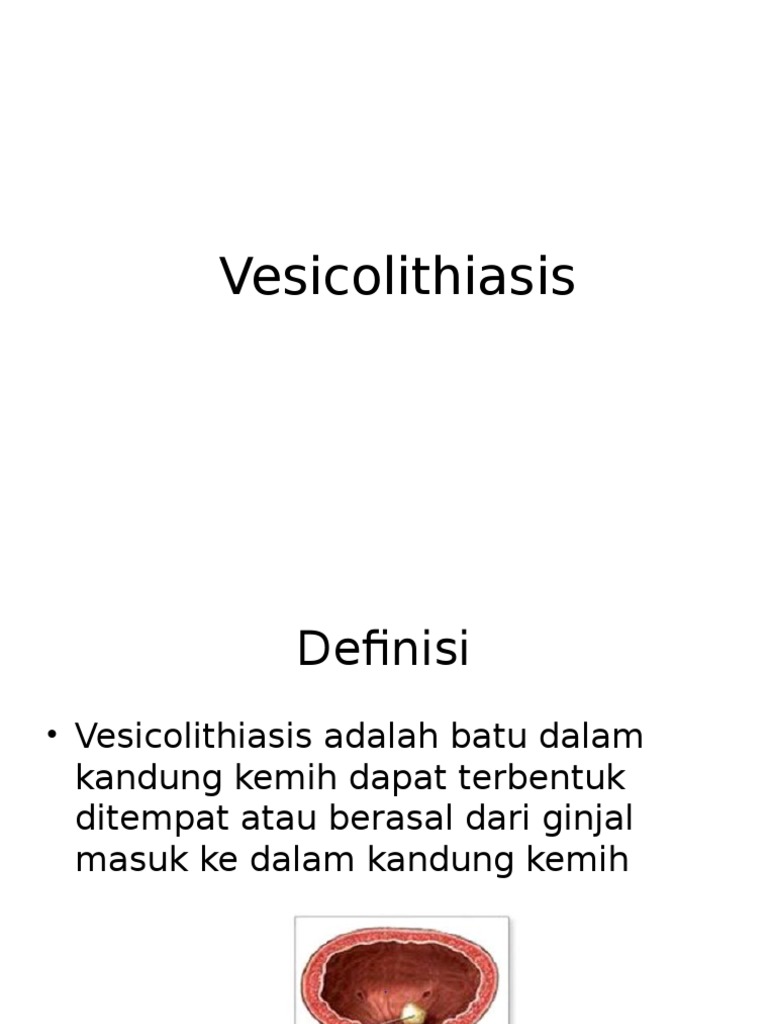Vesicolithiasis | PDF | Ilmu Sosial | Kesehatan Holistik