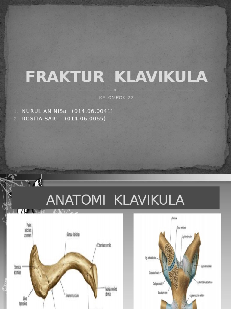 Fraktur Klavikula | PDF